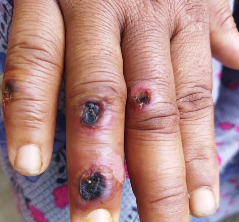 Understanding Zoonotic Diseases: Can Animals Make You Sick? | Insights ...