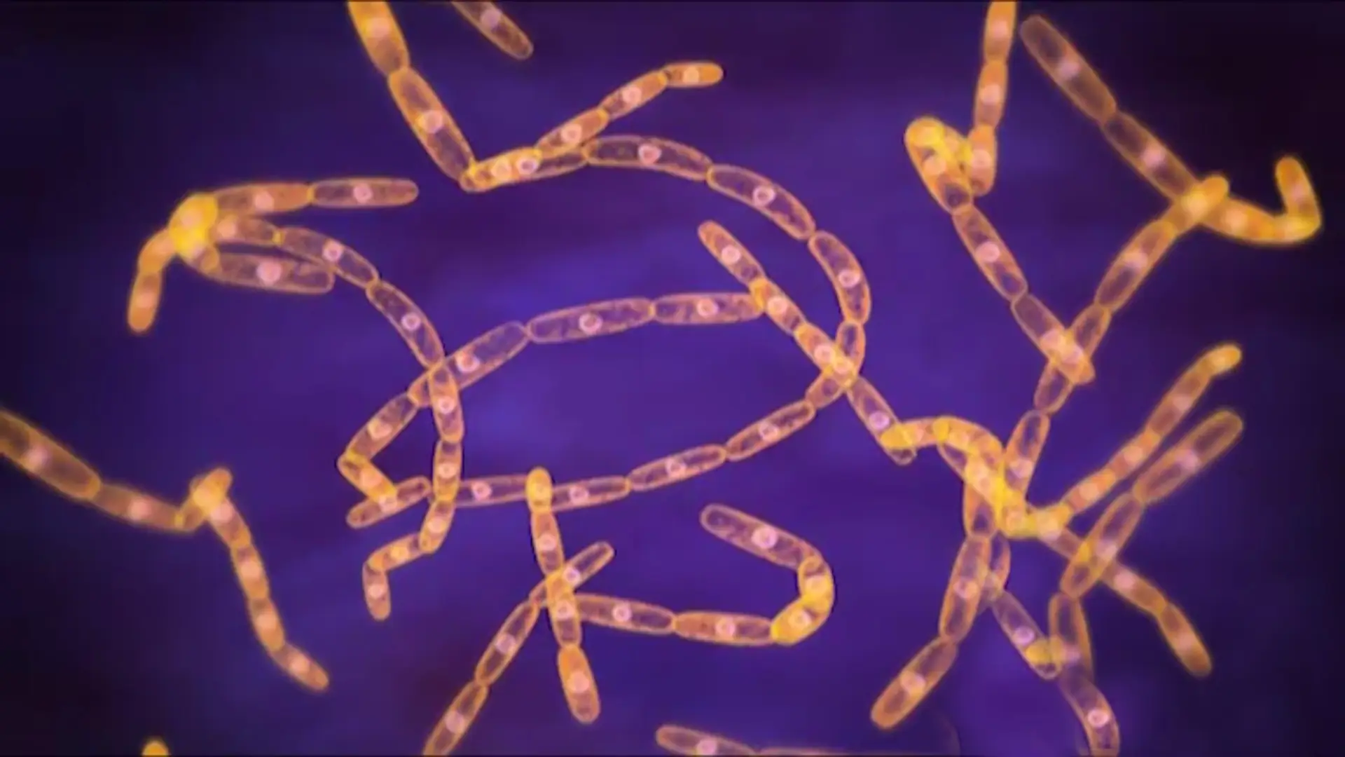 Anthrax | Insights into Pathogens and Health | Germsights